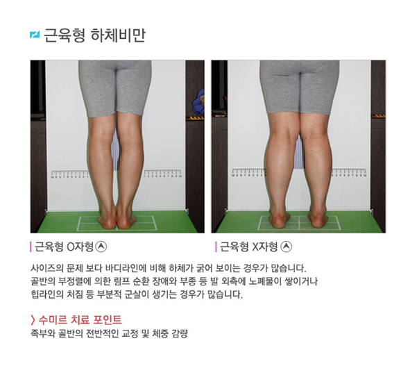 골반 틀어짐 원인 증상 하체라인으로 확인 네이버 블로그