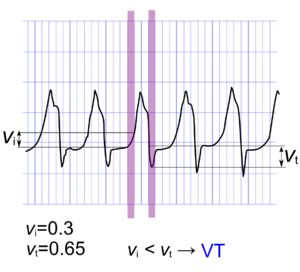 VT algorithm : 네이버 블로그